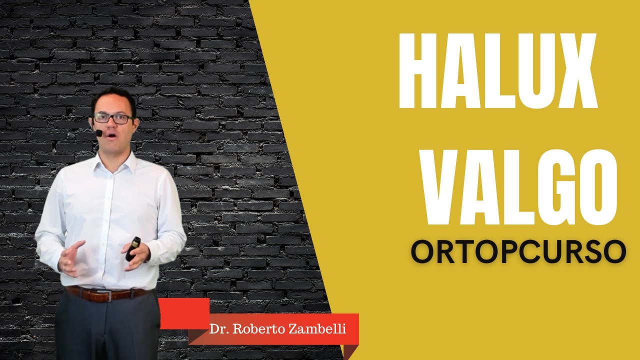 Halux Valgo - ORTOPCURSO - YouTube