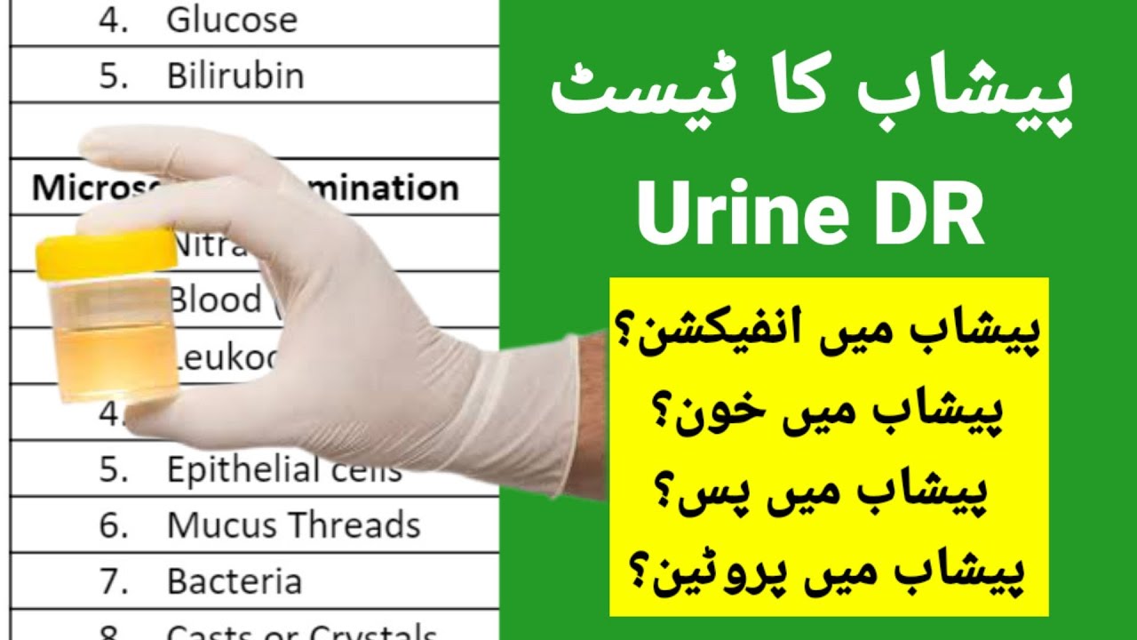 Urine Test In Hindi Urdu Understand Urine Analysis Report How To urine-test-in-hindi-urdu-understand-urine-analysis-report-how-to