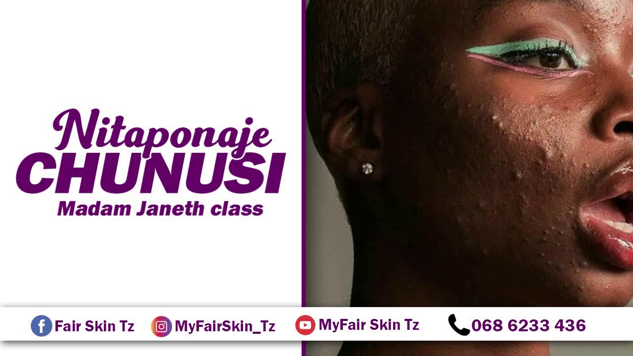 Nitaponaje Chunusi Sababu kuu tatu za chunusi by My Fair Skin TZ - how ...