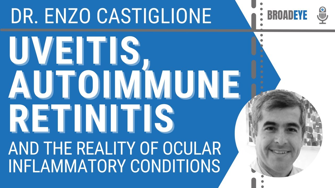 Uveitis, Autoimmune Retinitis and Reality Of Ocular Inflammatory ...