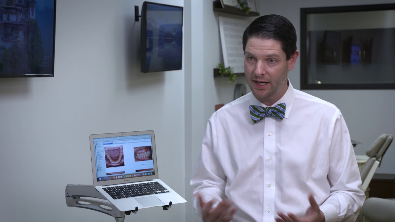 Dr. Burton describes how he uses 3D technology in Orthodontics - YouTube