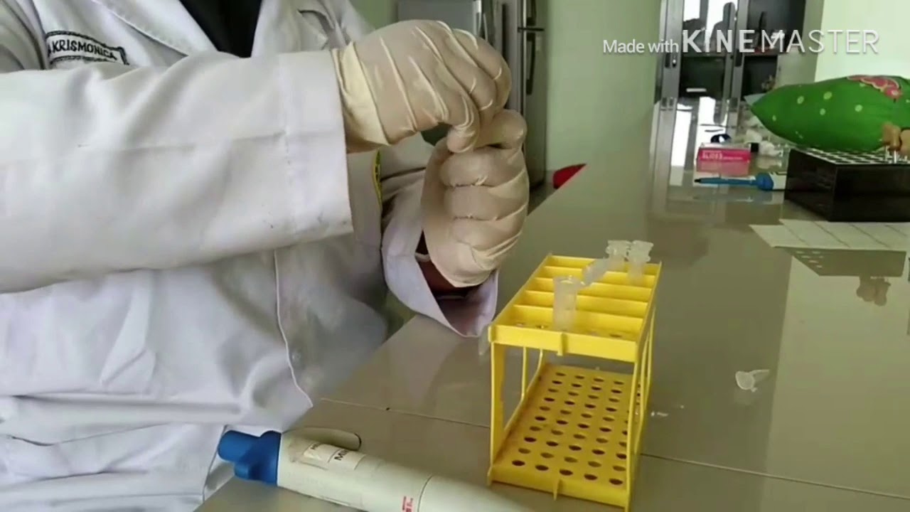 Pemeriksaan Golongan Darah Reverse Grouping - YouTube