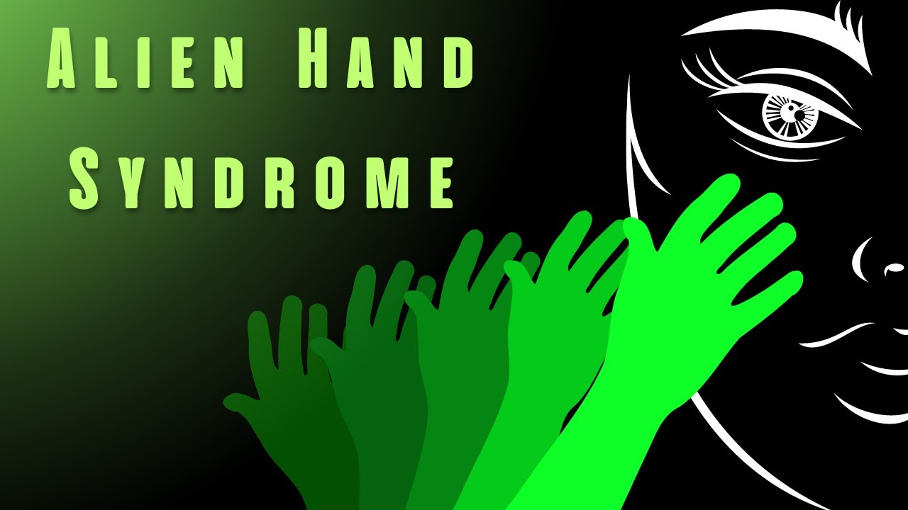 My Hand has Betrayed Me | Alien Hand Syndrome - YouTube