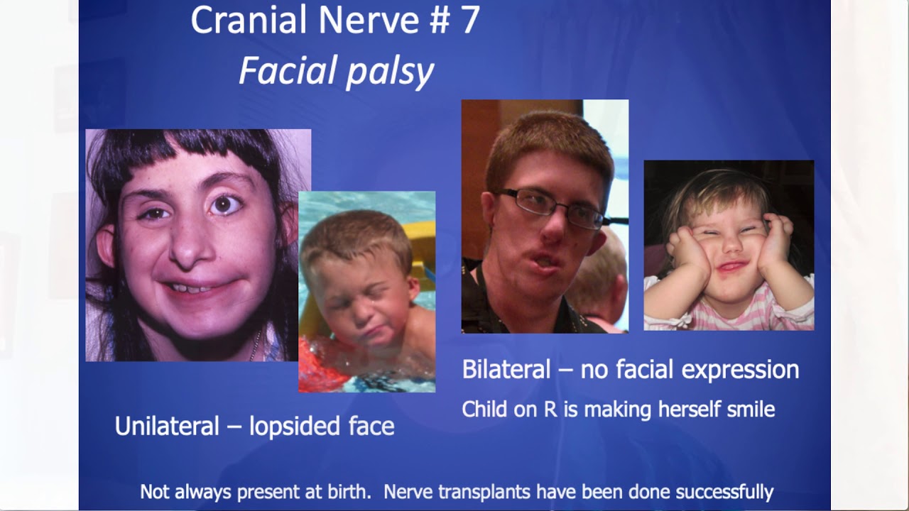 Meg Hefner Major Diagnostic Features - YouTube