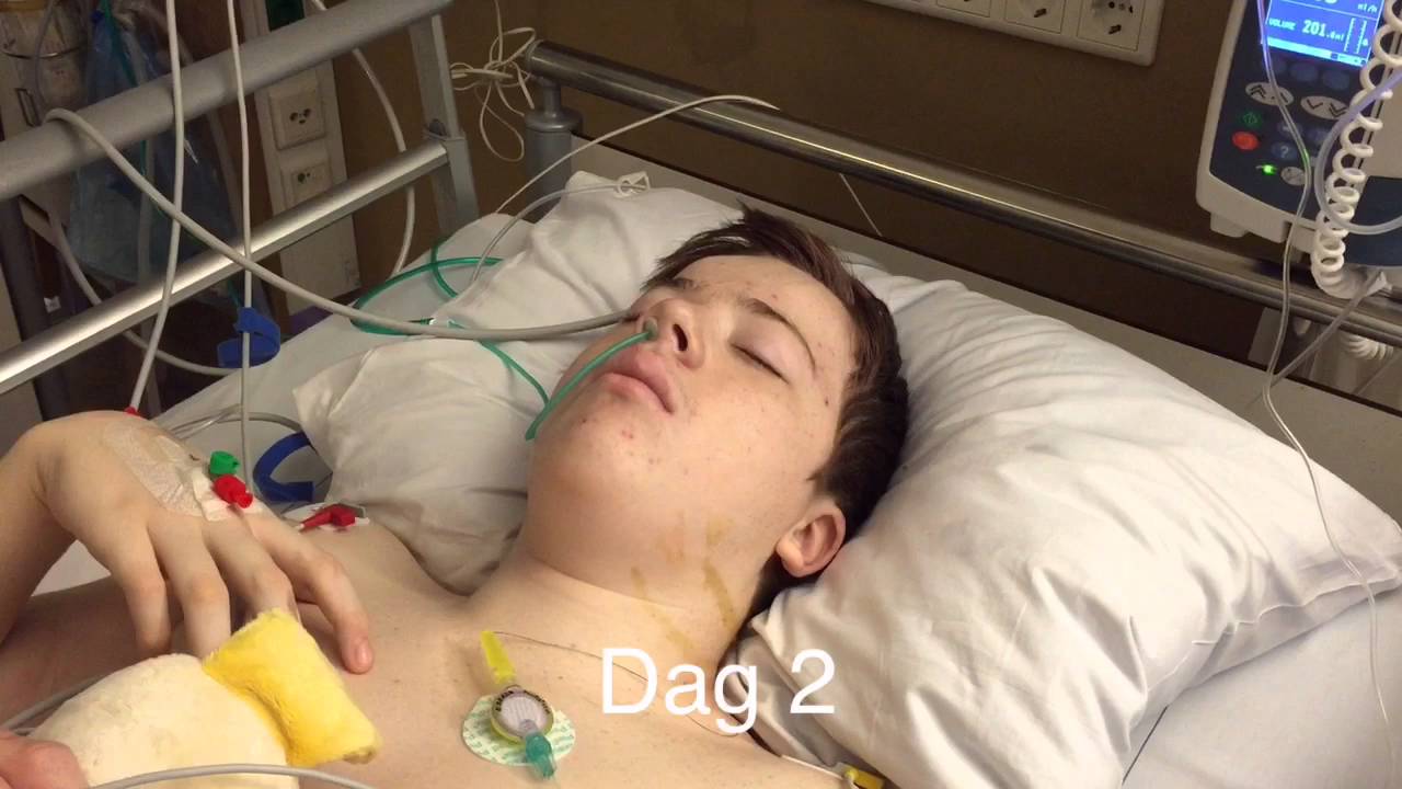 SCOLIOSE OPERATIE! - YouTube