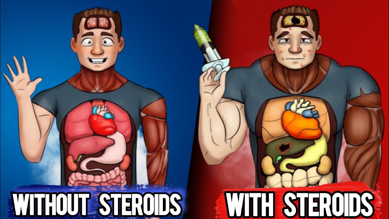 Side Effects of Steroids On Bodybuilders | Steroids vs Natural | Human ...