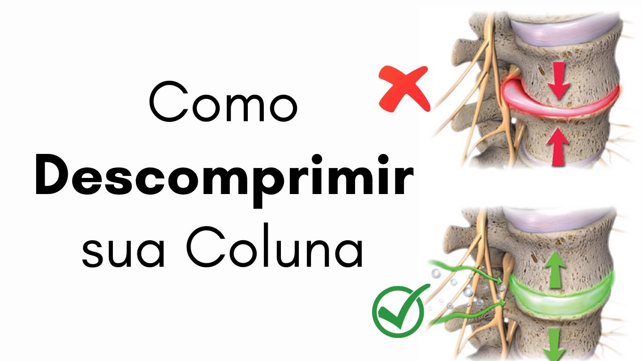 Como DESCOMPRIMIR sua Coluna - 3 exercícios para Salvar sua Coluna ...