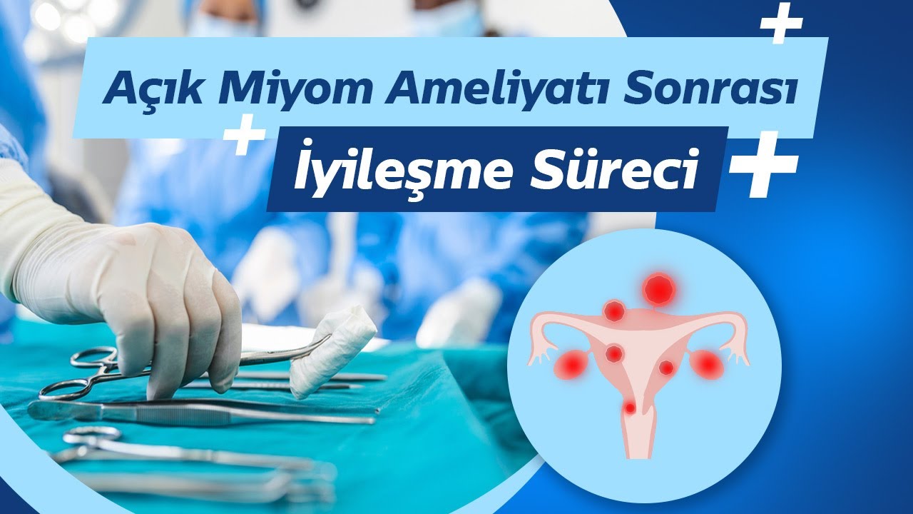Açık Miyom Ameliyatı Sonrası İyileşme Süreci Açık Miyom Ameliyatı ...