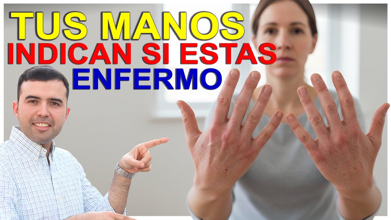 TUS MANOS REVELAN ENFERMEDADES! - Signos Y Síntomas Que Tus Manos Dicen ...