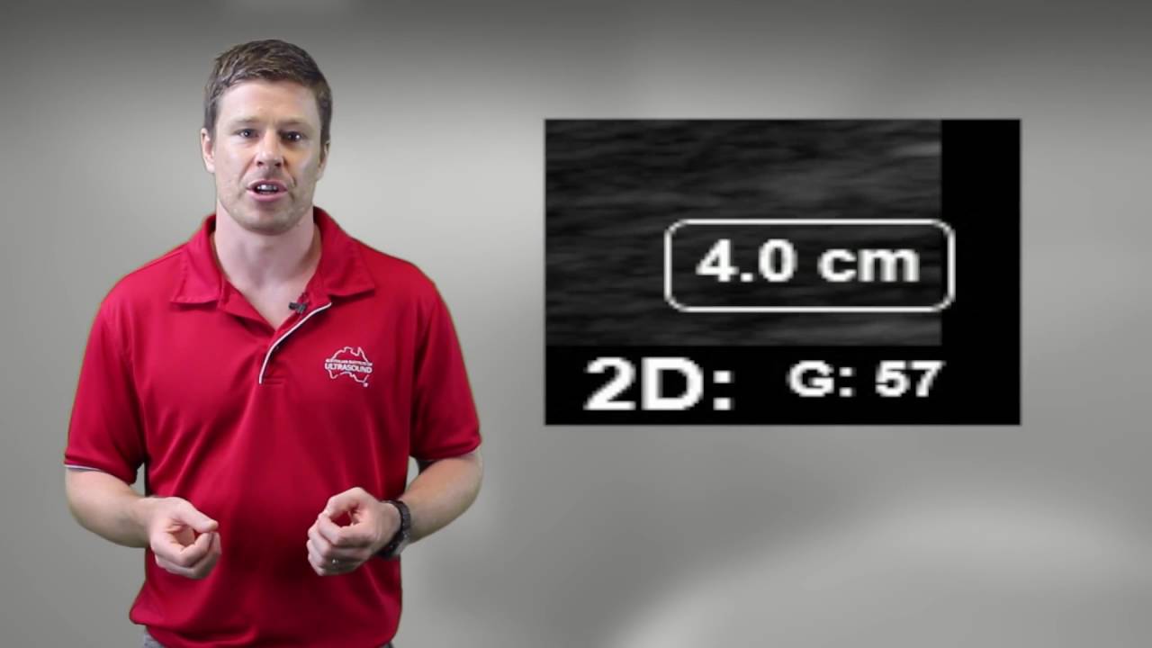 Ultrasound Guided Adductor Canal Block - YouTube