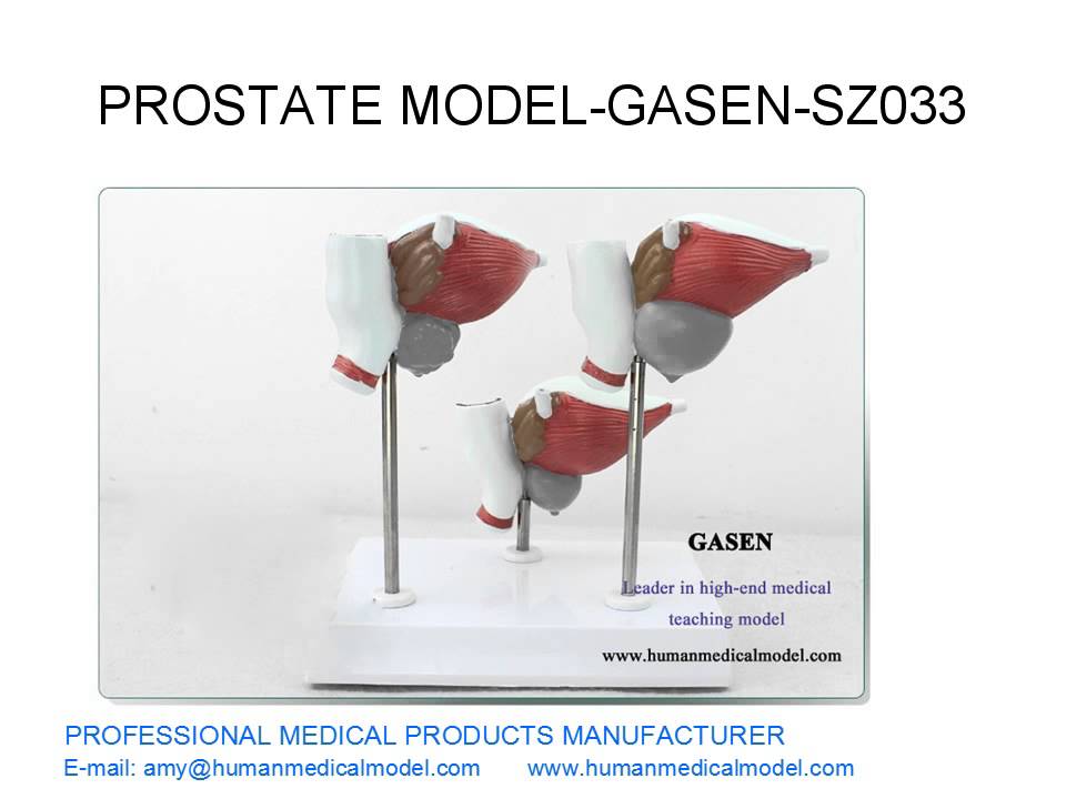 RECTO PRÓSTATA ENFERMA NORMAL Y COMÚN Y VEJIGA DEMOSTRACIÓN MODELO ...