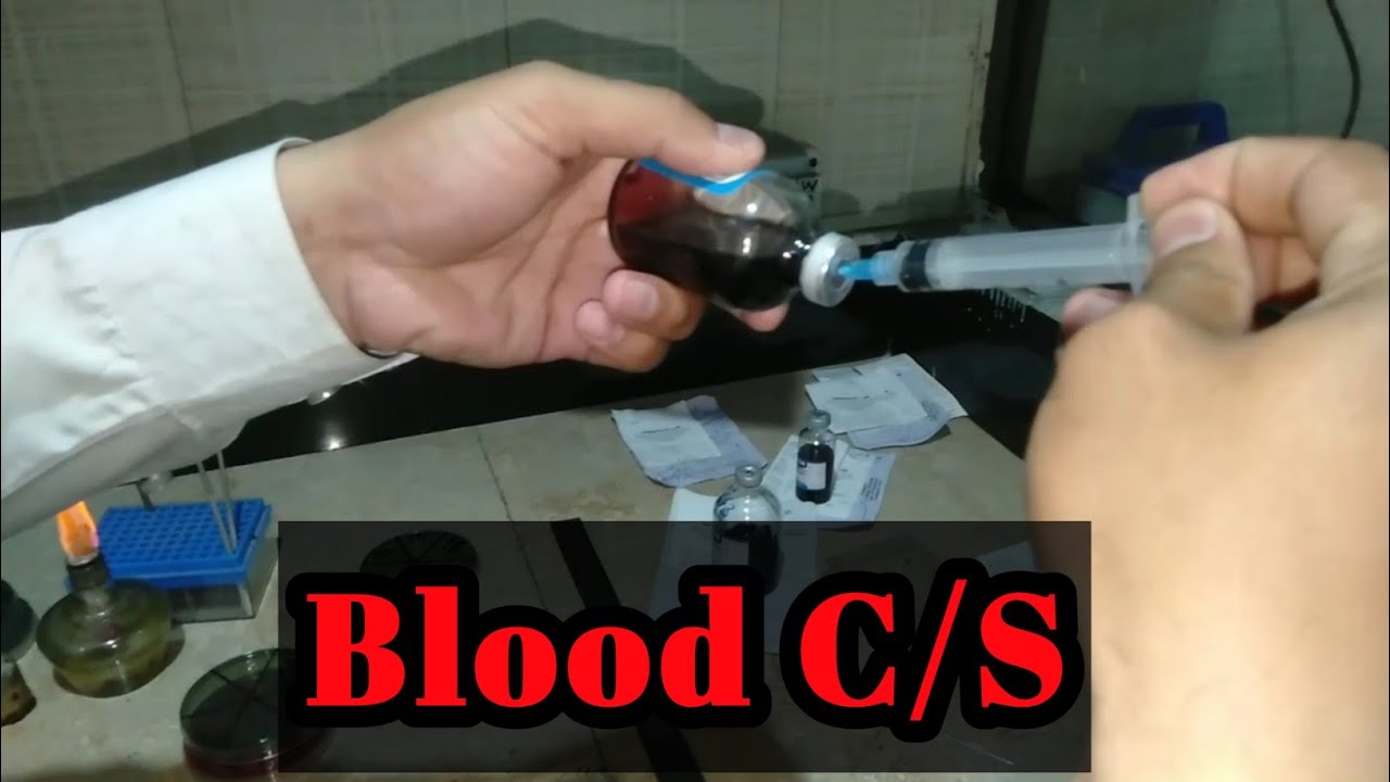 Blood culture sensitivity: Blood C/S - YouTube