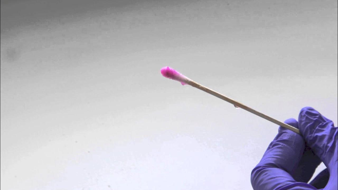 The Kastle Meyer Blood Test - YouTube