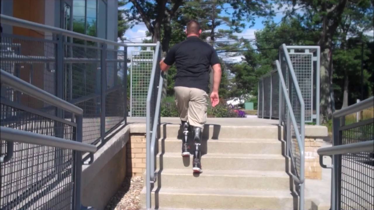 Dylan - Bilateral BK - Stairs - YouTube