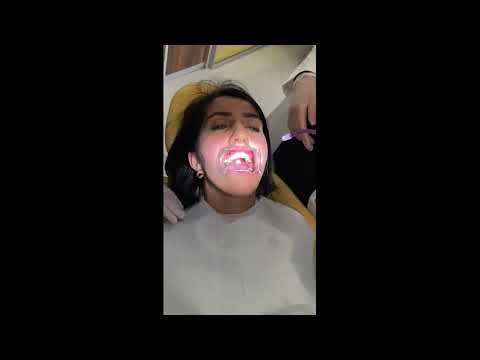Adeziv Diş Hekimliği | Prof.Dr.Hüseyin Kurtulmuş