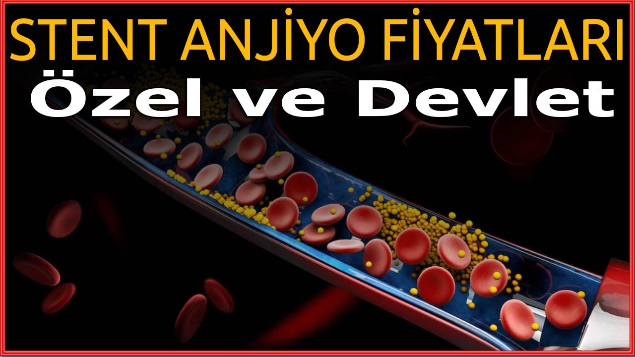 Anjiyo Stent Fiyatları Özel Hastane ve Devlet Hastanesi Güncel ...