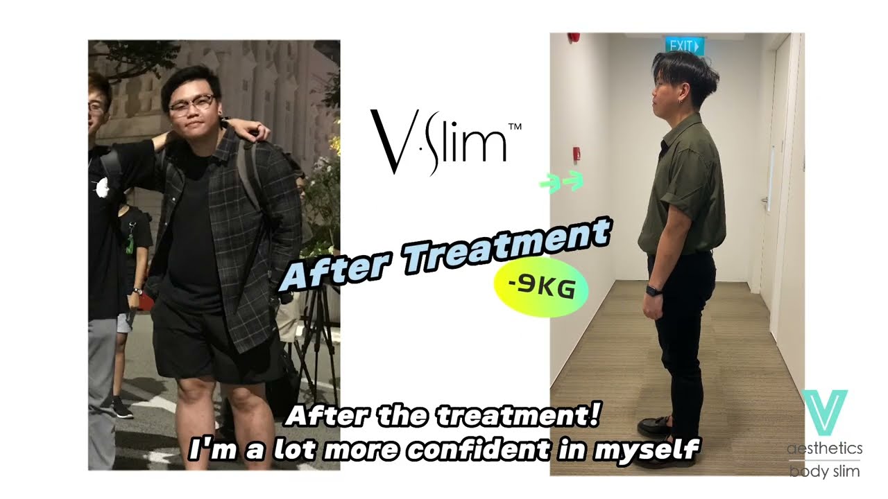 Slimming Treatment Centre in Singapore | V Aesthetic Body Slim