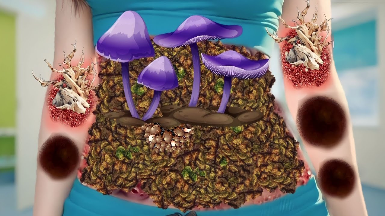 ASMR Girl Belly Treatment 2D Animation Video | Relaxing Video | ASMR ...