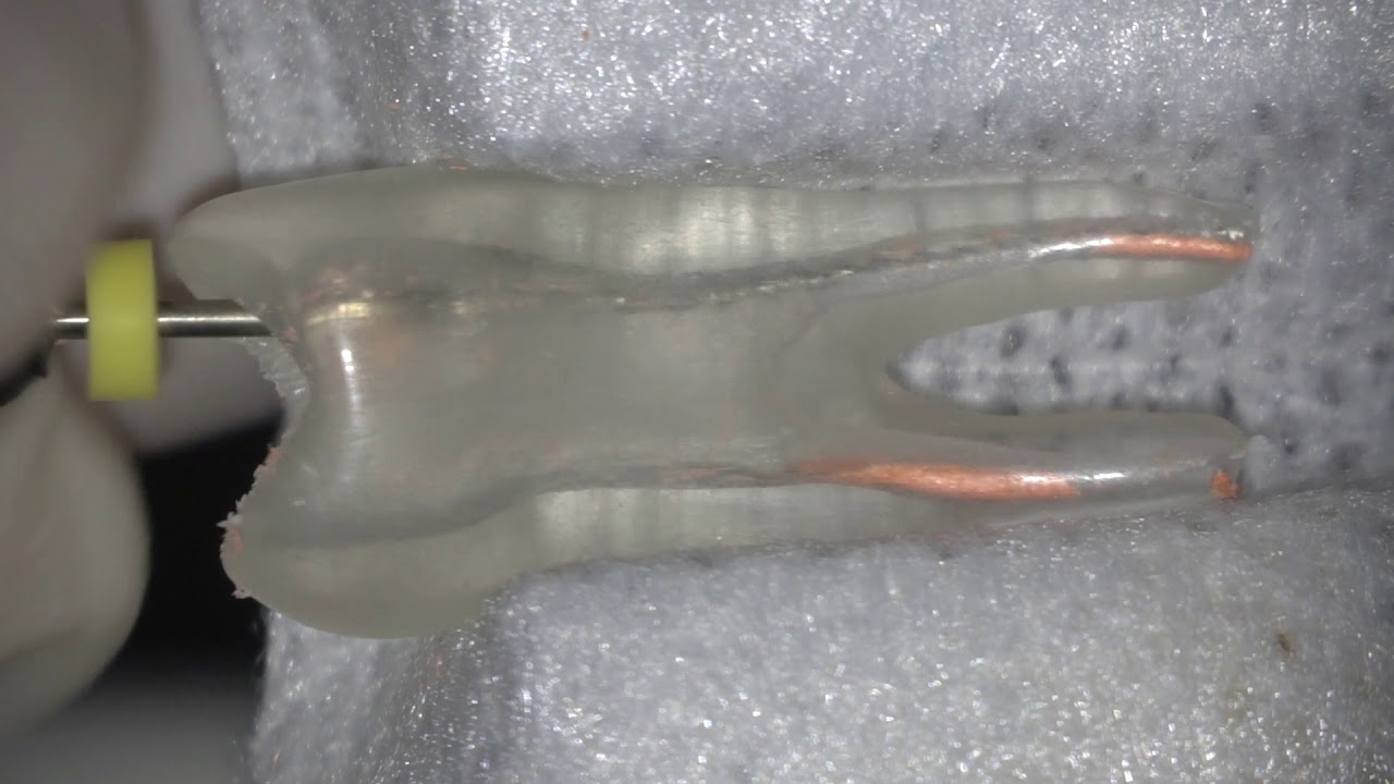 Hyflex remover - YouTube