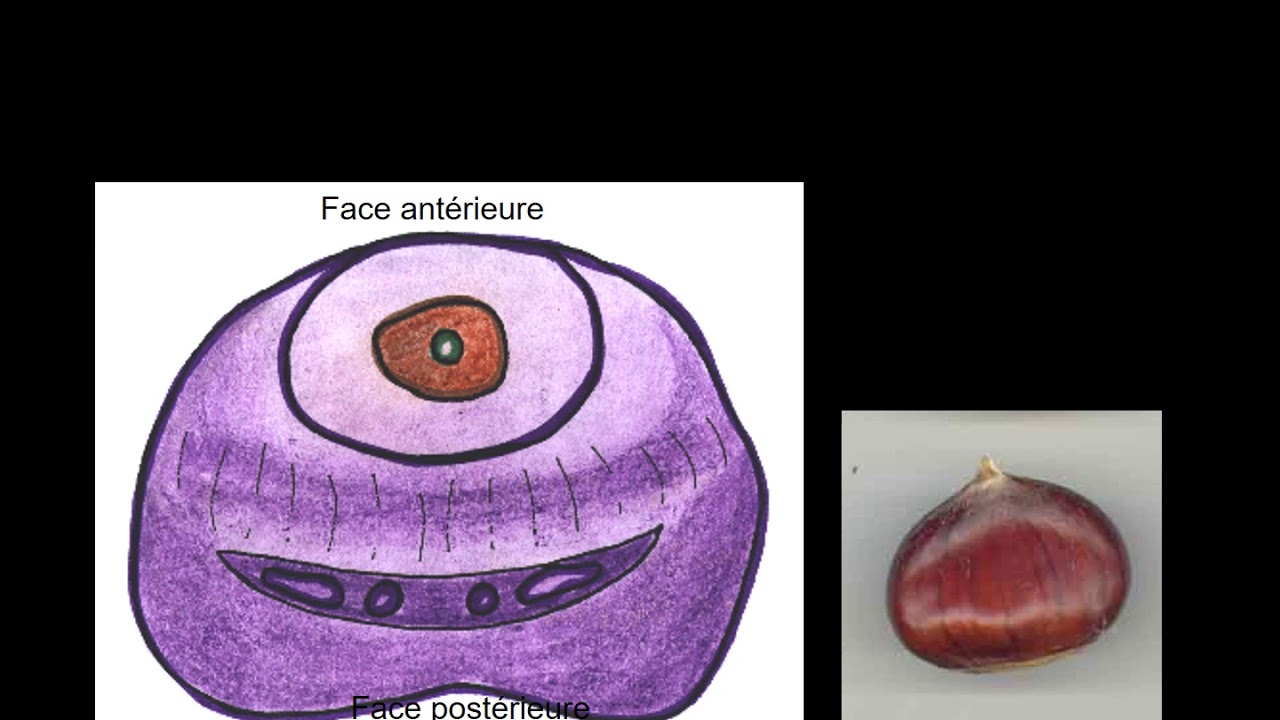 prostate et loge prostatique 1 - YouTube