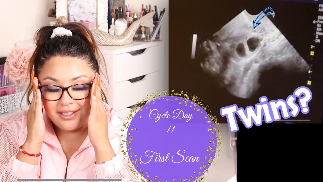 My First Follicle Scan||Cycle Day 11 - YouTube