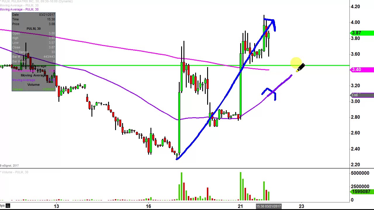 Pulmatrix Inc - PULM Stock Chart Technical Analysis for 03-21-17 - YouTube