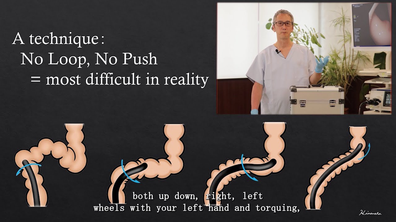 Colonoscopy Insertion Technique with Mikoto Model: How to avoid loops ...