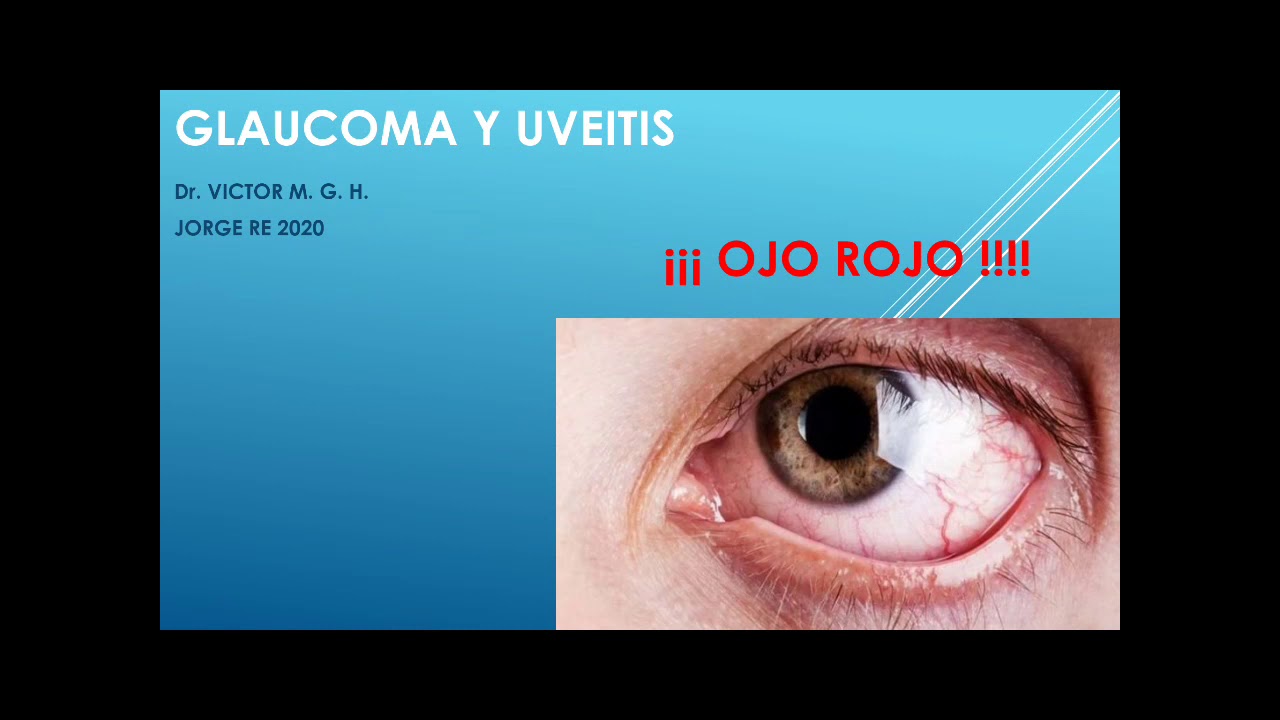 GLAUCOMA Y UVEITIS: OJO ROJO ! - YouTube