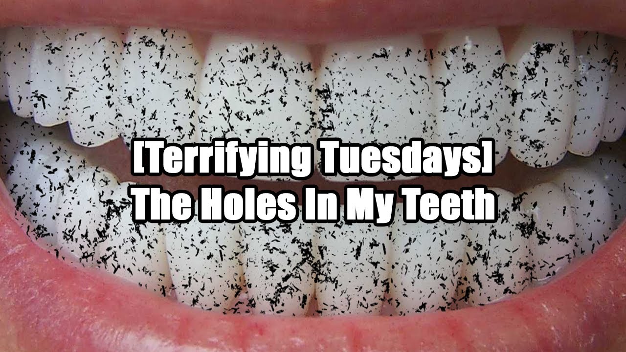 [Terrifying Tuesdays] The Holes In My Teeth - YouTube