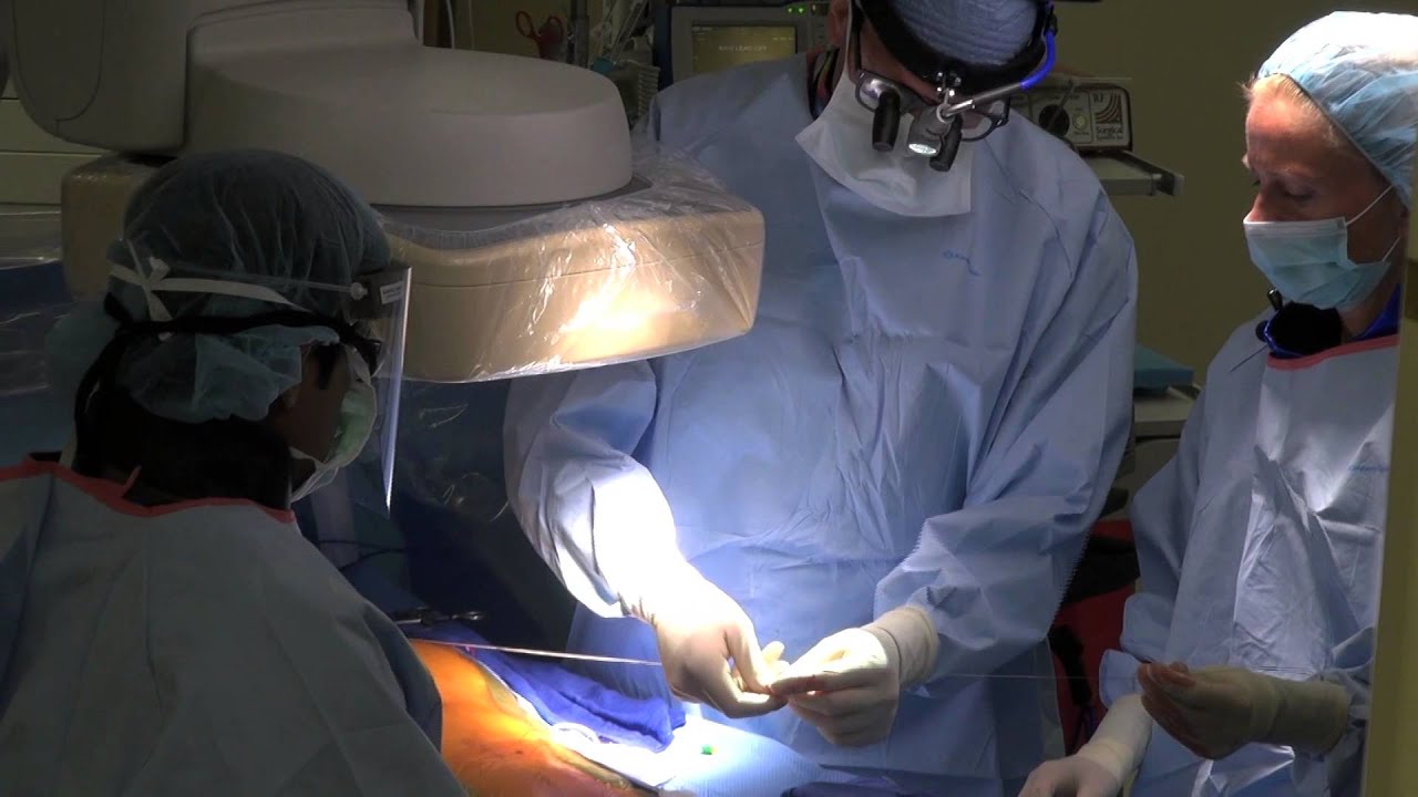 UC San Diego Cardiology Team Performs 100th Extraction Procedure with ...