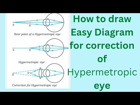 Easy diagram for correction of Hypermetric eye👁️🧐#science #class10 # ...