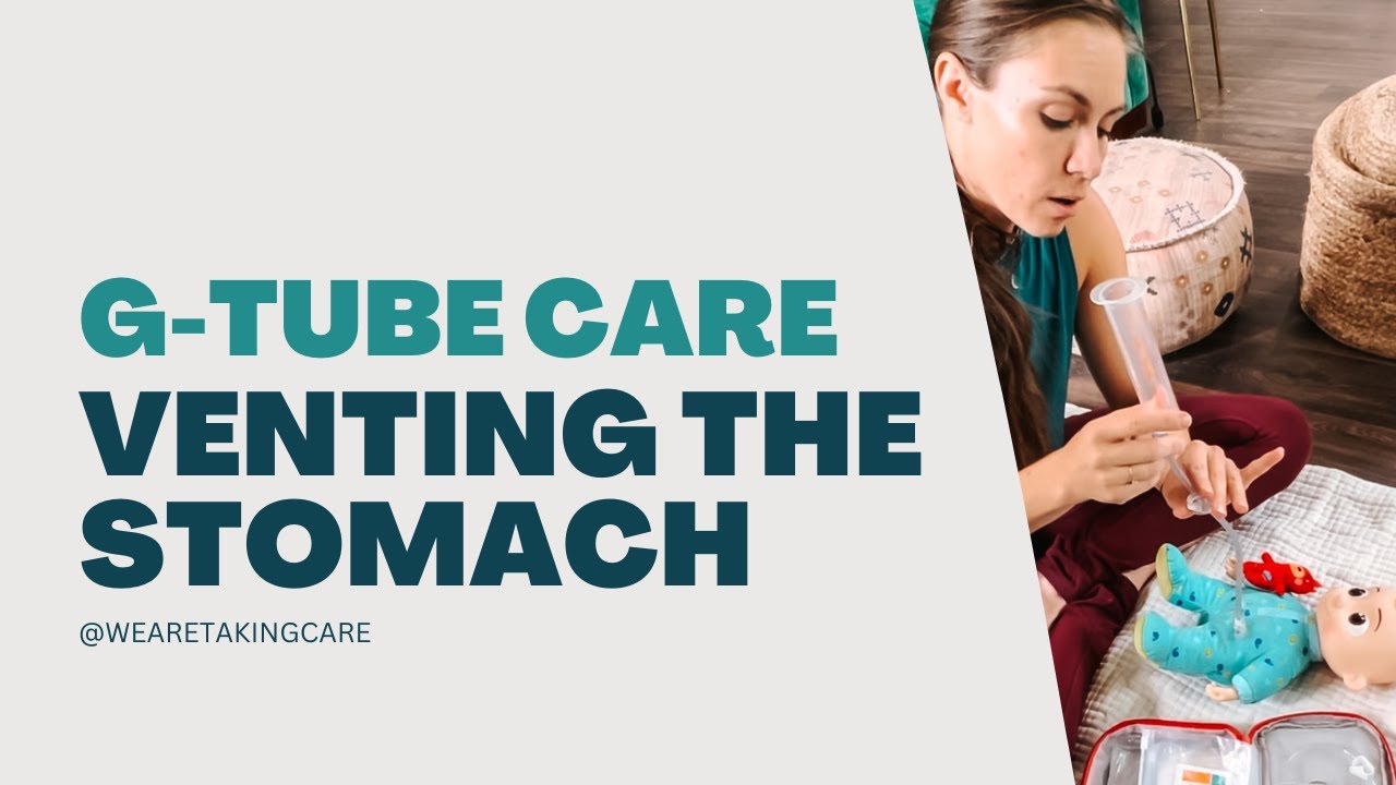 G-tube Care: Venting the stomach using the G tube button - YouTube
