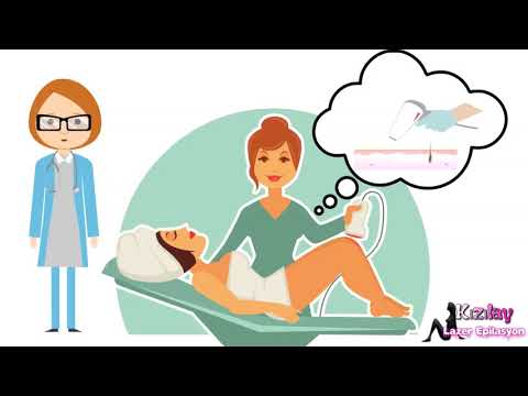 İşletme Tanıtım Videosu | Kızılay Lazer Epilasyon