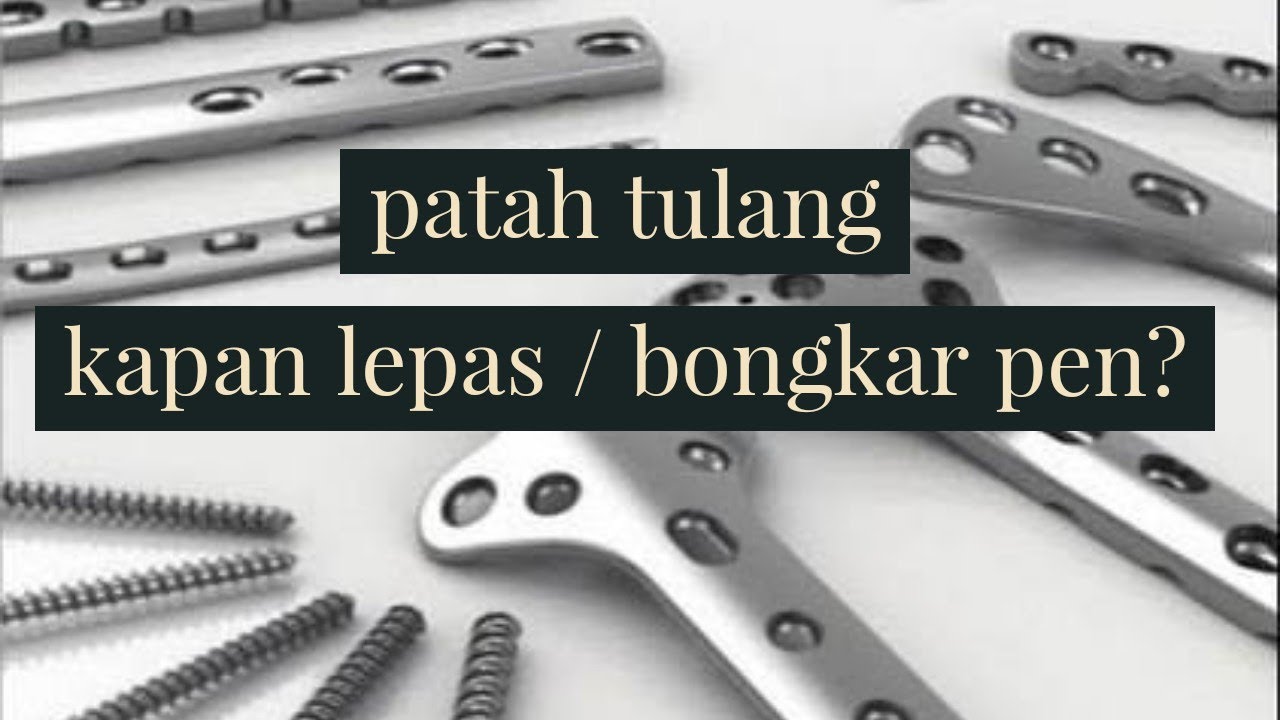 patah tulang pasang pen kapan bisa di lepas / bongkar? - YouTube