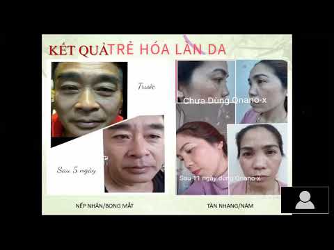 Dược mỹ phấm NSZ World: Q NANO X