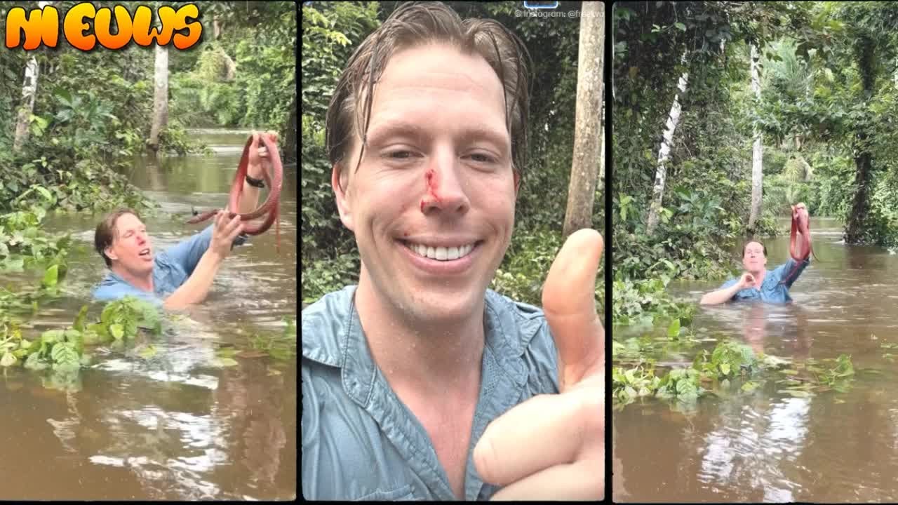 Freek Vonk weer aangevallen door wild dier: ditmaal slangenbeet - YouTube