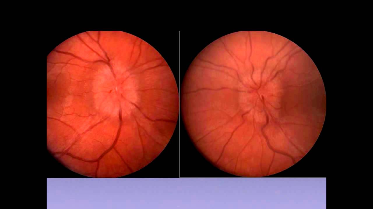 Contenidos abiertos: Entrevista al Dr. Prem Subramanian + "Pseudomotor ...