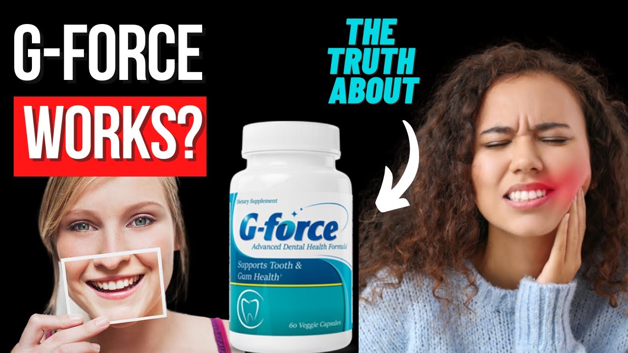 🔴 G-FORCE TEETH REVIEWS 🔴 Is G-FORCE Worth It? ⚠️ G-Force Dental - YouTube