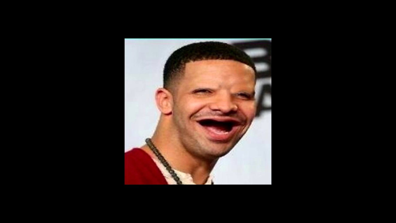 Drake Without Eyebrows And Teeth