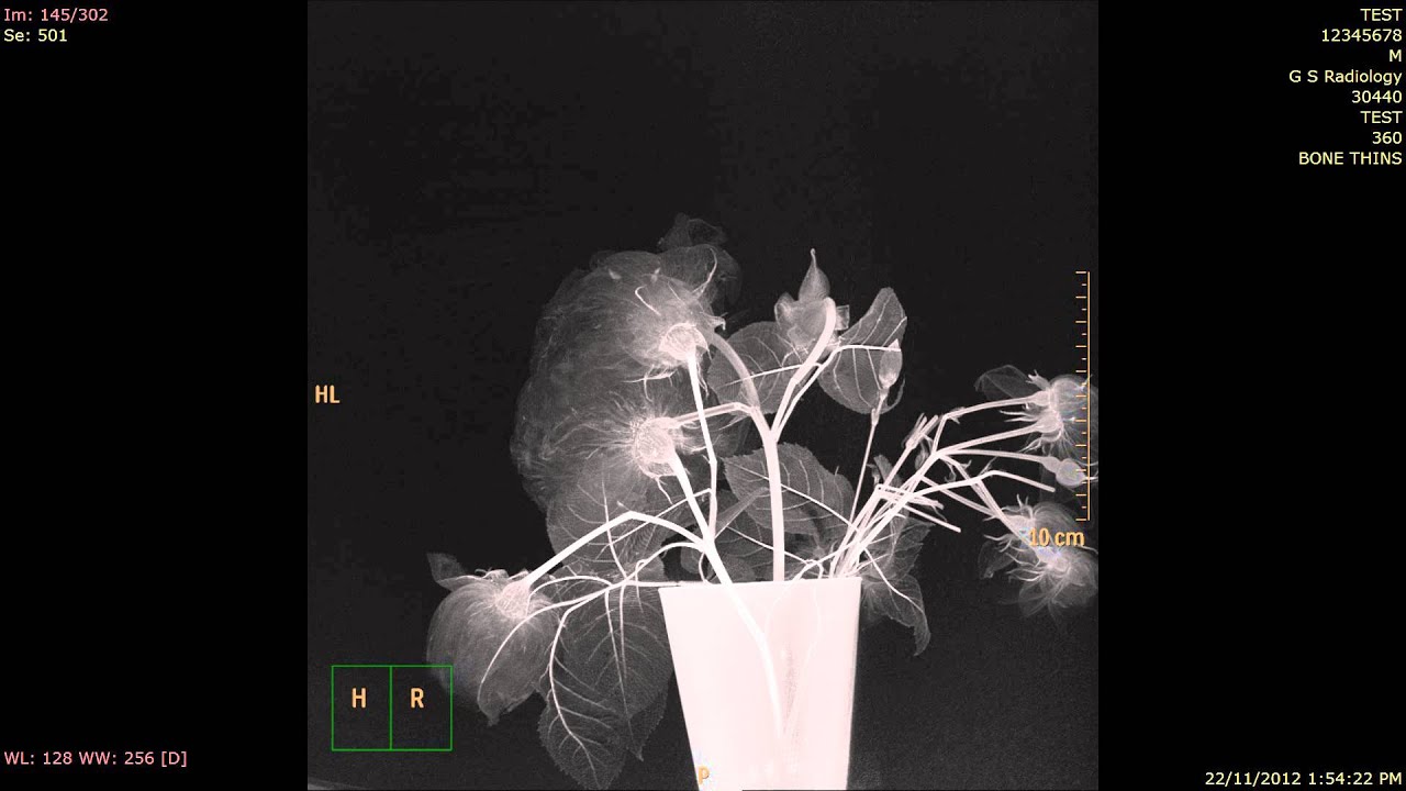 CT Scan 3D Volume MIP bunch of flowers - YouTube