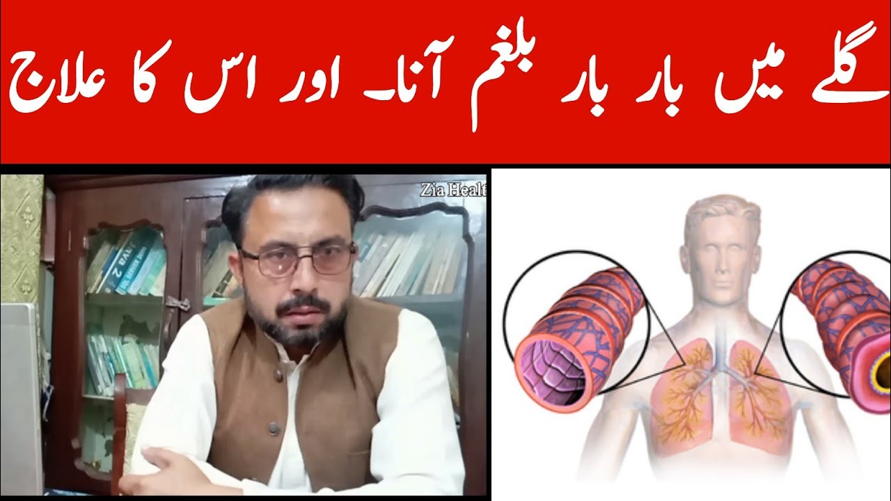 "Unlocking the Cure: Understanding Causes, Symptoms, and Treatment of ...