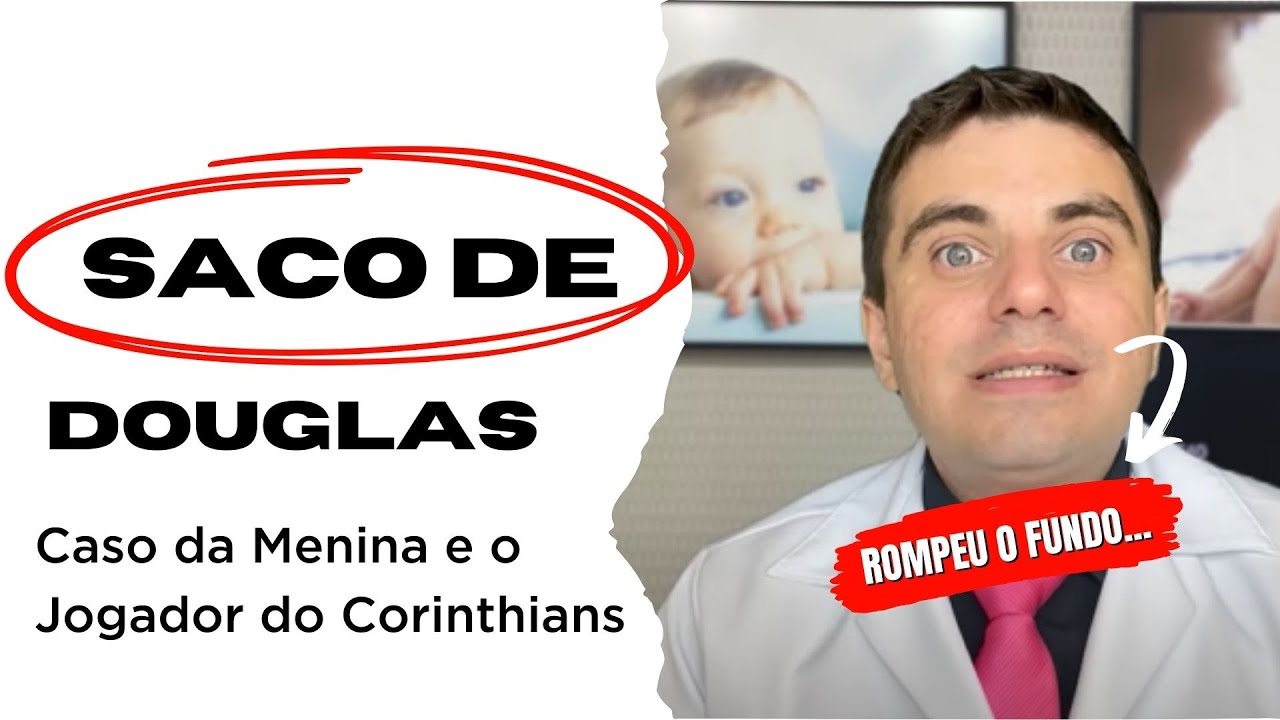 Laceração do Fundo de Saco de Douglas - entenda! - YouTube