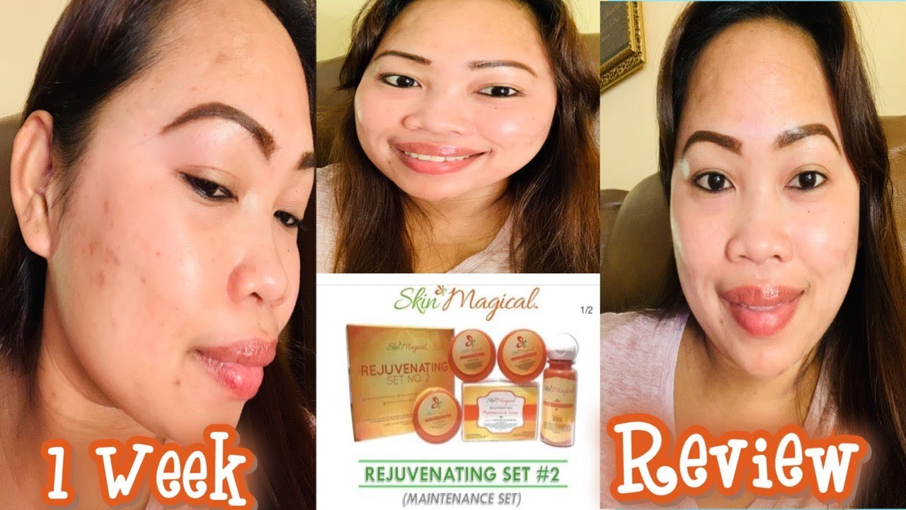 1 WEEK REVIEW SKIN MAGICAL REJUVENATING SET 2 - YouTube