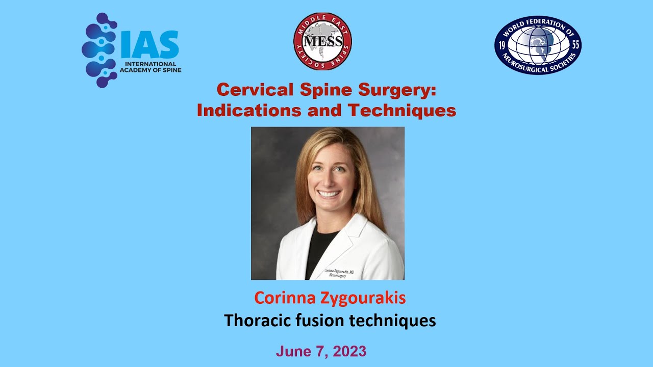 Thoracic Spine Surgery: Corinna Zygourakis: Thoracic fusion techniques ...