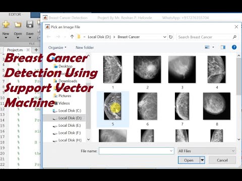 Breast Cancer Detection Using Support Vector Machine Algorithm IEEE ...