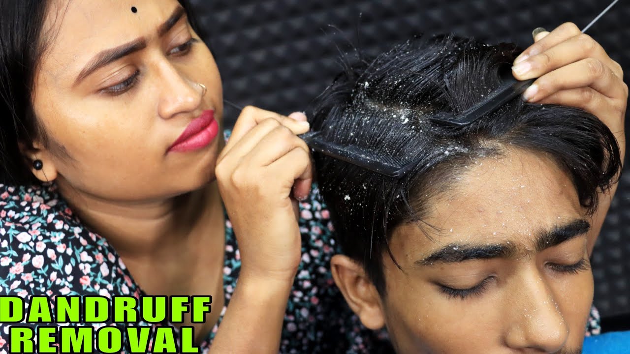 Satisfying Dandruff Scratching with Comb | Dandruff Removal & Treatment ...
