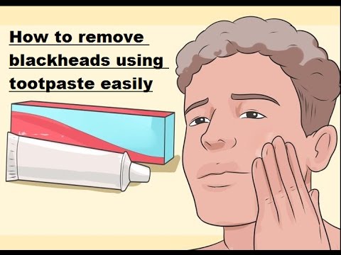 How to remove blackheads with toothpaste from nose or face - DIY - YouTube