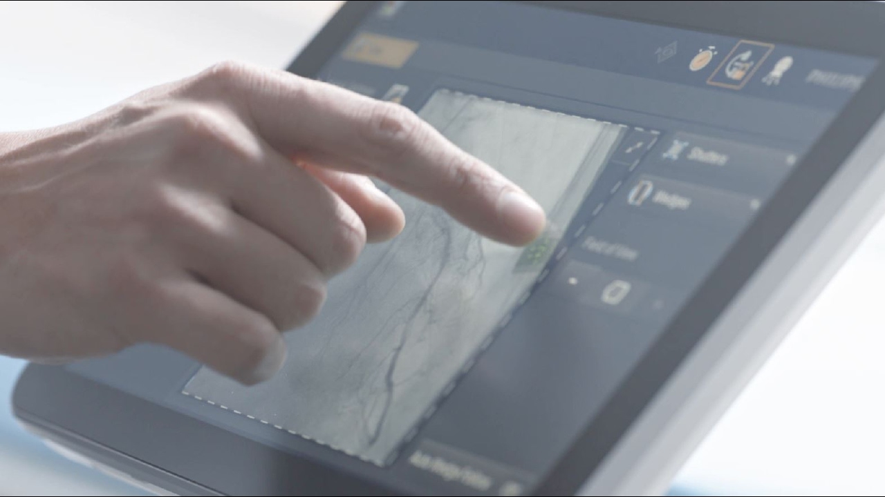 Philips Azurion. Key product features and system design - YouTube