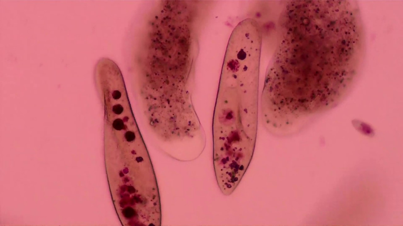 Amoeba extends pseudopods to capture its prey - YouTube