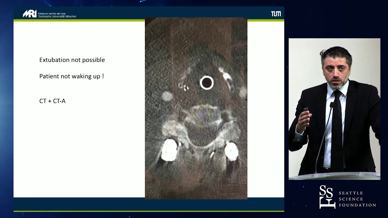 Navigating towards disaster: cervical case - Ehab Shiban - YouTube